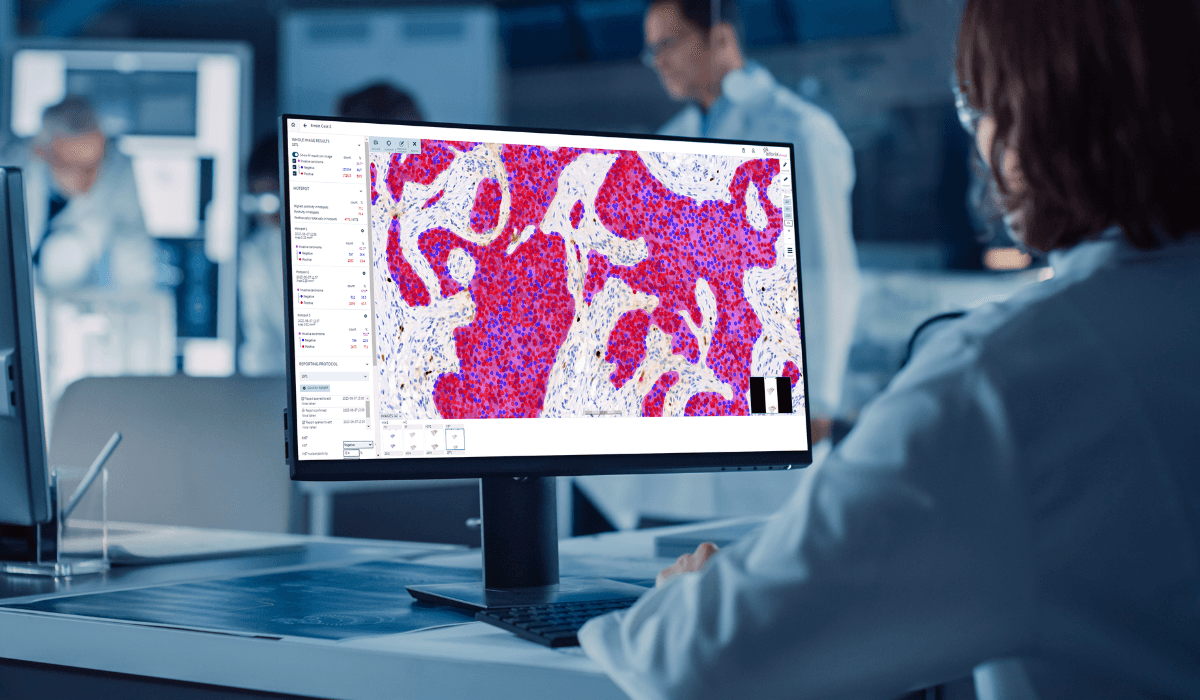 Aiforia delivers AI-powered digital pathology solutions through Google ... Aiforia delivers AI-powered digital pathology solutions through Google ...